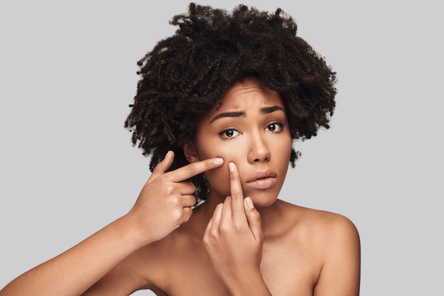 The Best Way to Pop a Pimple for a Blemish-Free Complexion